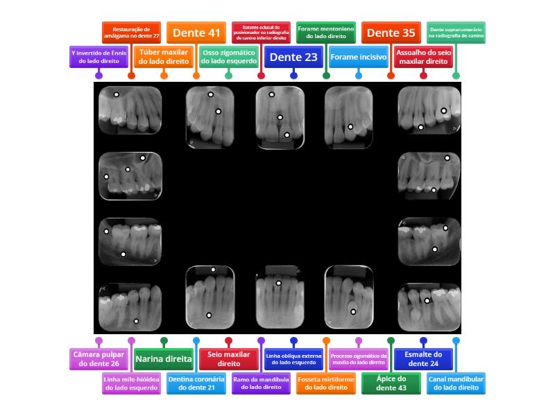 Anatomia radiográfica intraoral - Imagem com legenda