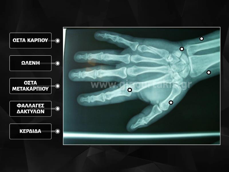 ΟΣΤΑ - Labelled diagram