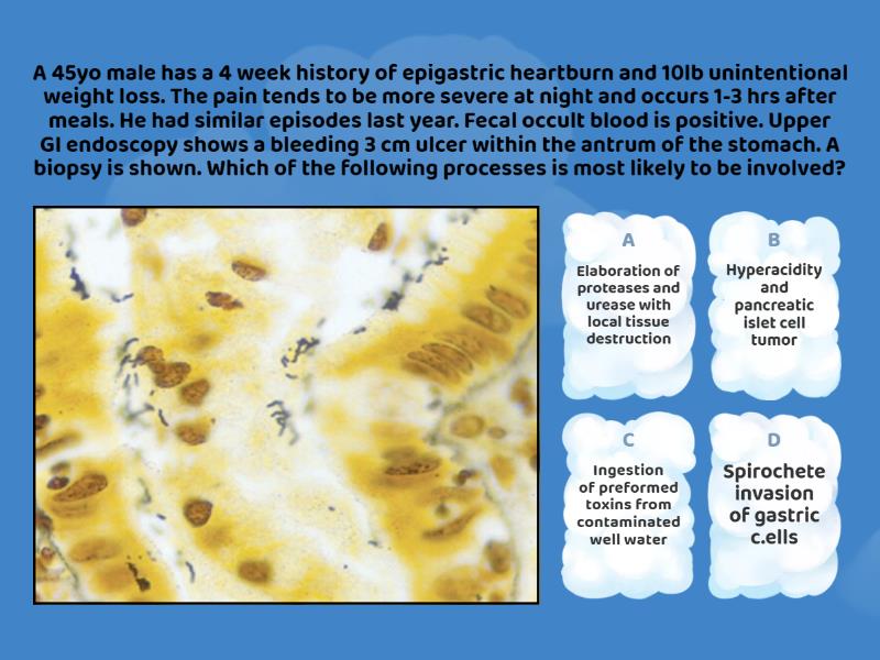 Peptic ulcer disease - Quiz
