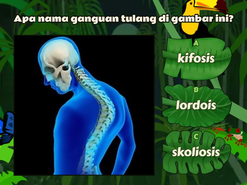 QUIS PENYAKIT YANG MENYERANG SISTEM GERAK - Quiz