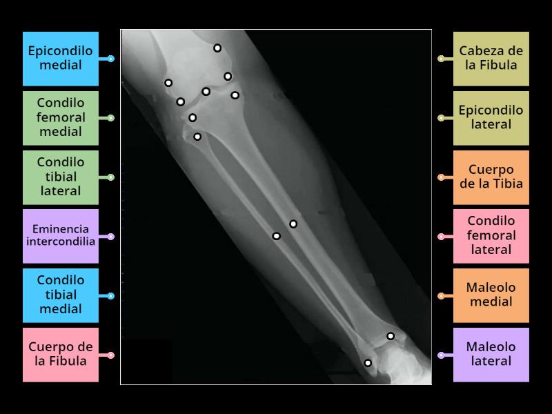 Anatomia de rx pierna AP - Labelled diagram