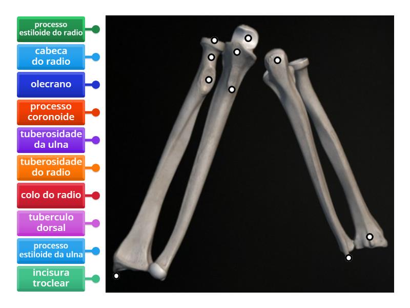 radio e ulna - Labelled diagram